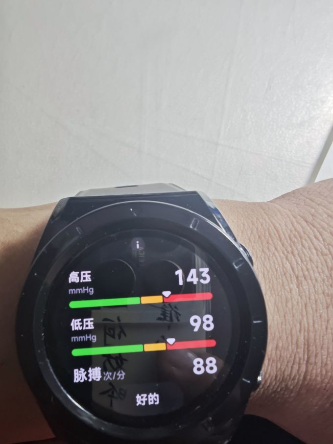 小米血压手表WATCH H1避坑指南_什么值得买